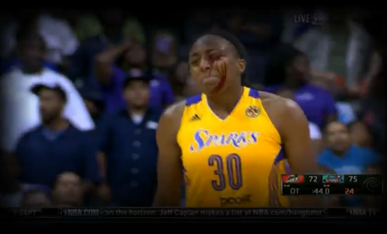 WNBA Star Injured in Team Celebration: VIDEO - The Hollywood Gossip