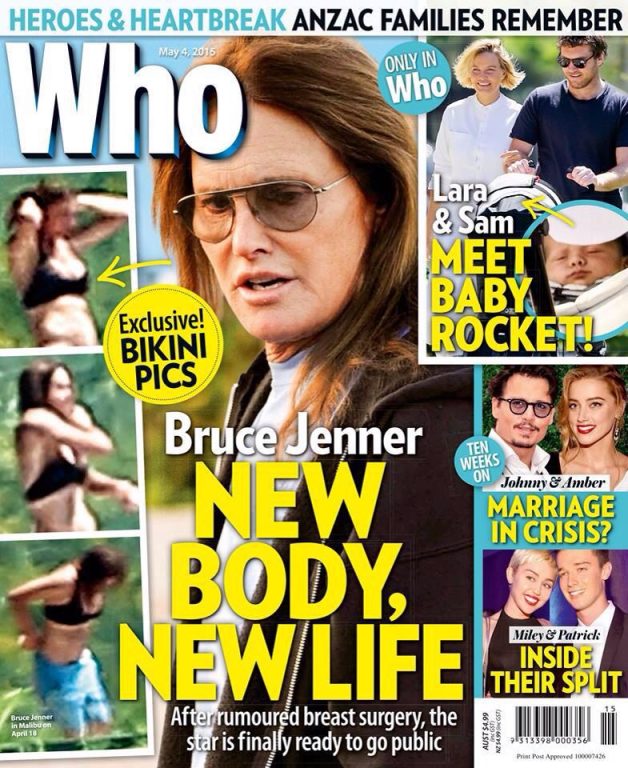 29 Photos of Bruce Jenner's Transition to Caitlyn Jenner - The ...