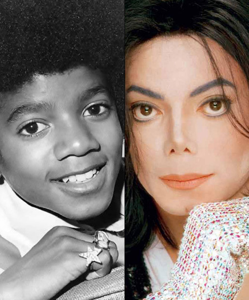 20 Celebrity Nose Jobs You Won't Believe - The Hollywood Gossip