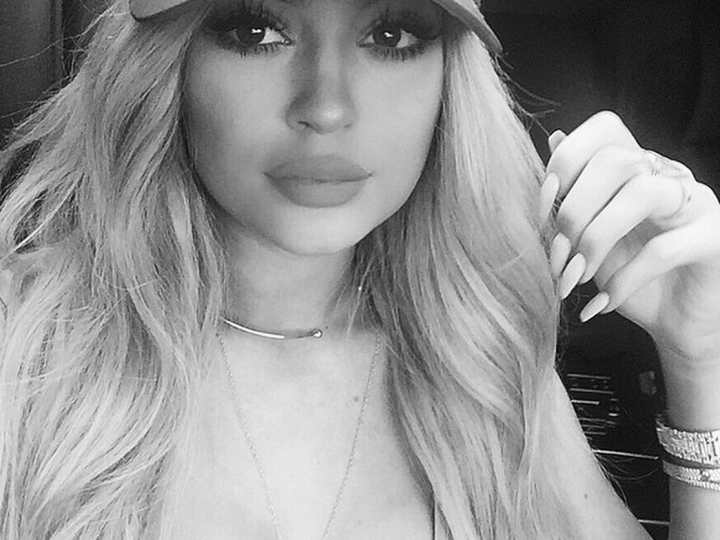 Kylie Jenner Lip Challenge Results In Serious Injuries Pissed Off