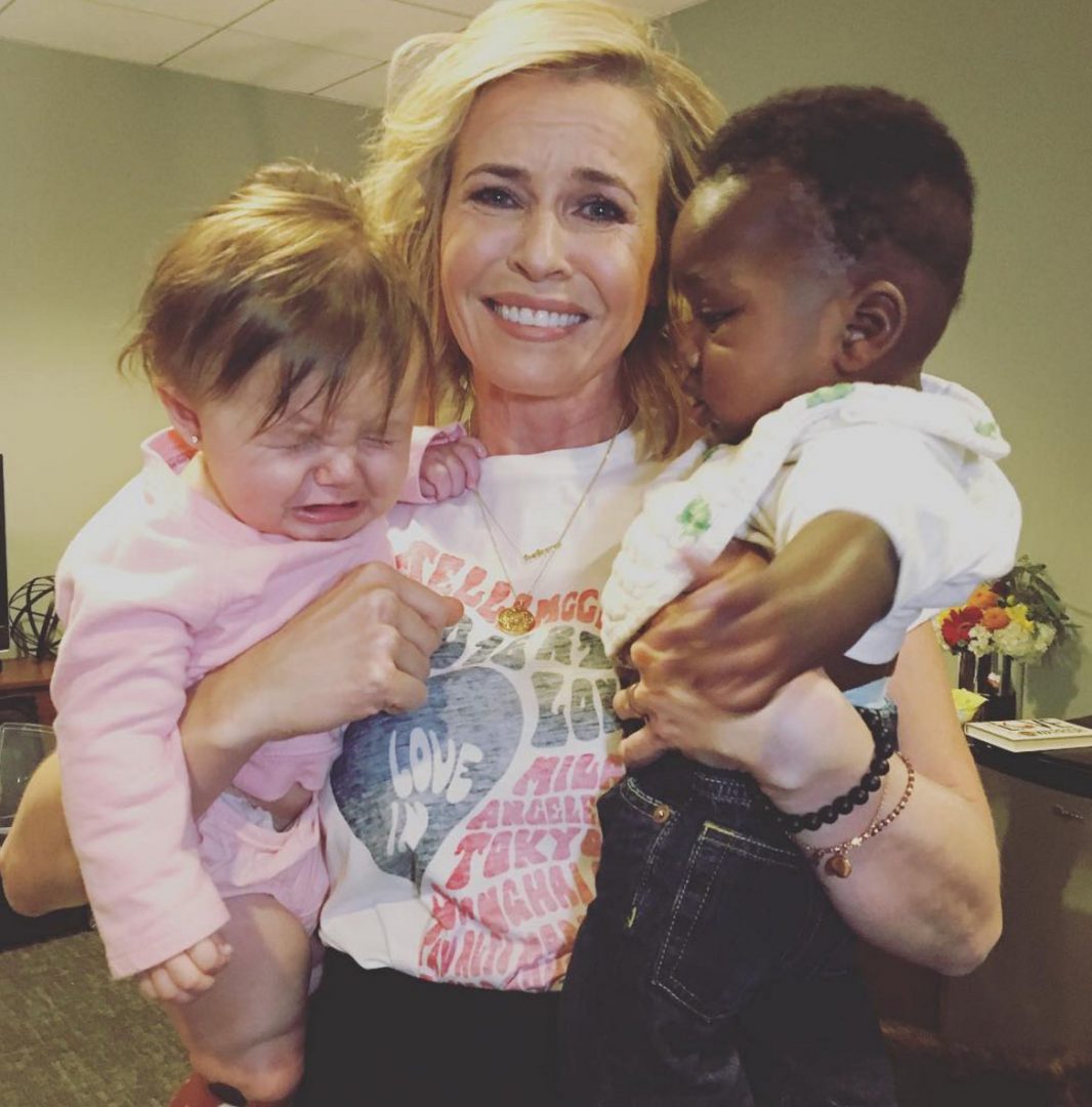 Chelsea Handler Looks Half Her Damn Age After Laser Facial: See the ...