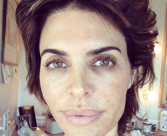 19 Celebrities Who Destroyed Their Lips - The Hollywood Gossip