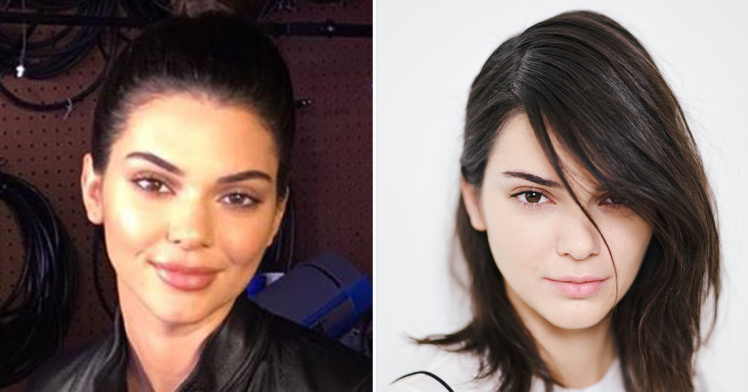 Kendall Jenner Left Instagram to Get Lip Injections? - The Hollywood Gossip