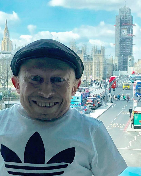 Verne Troyer in London - The Hollywood Gossip
