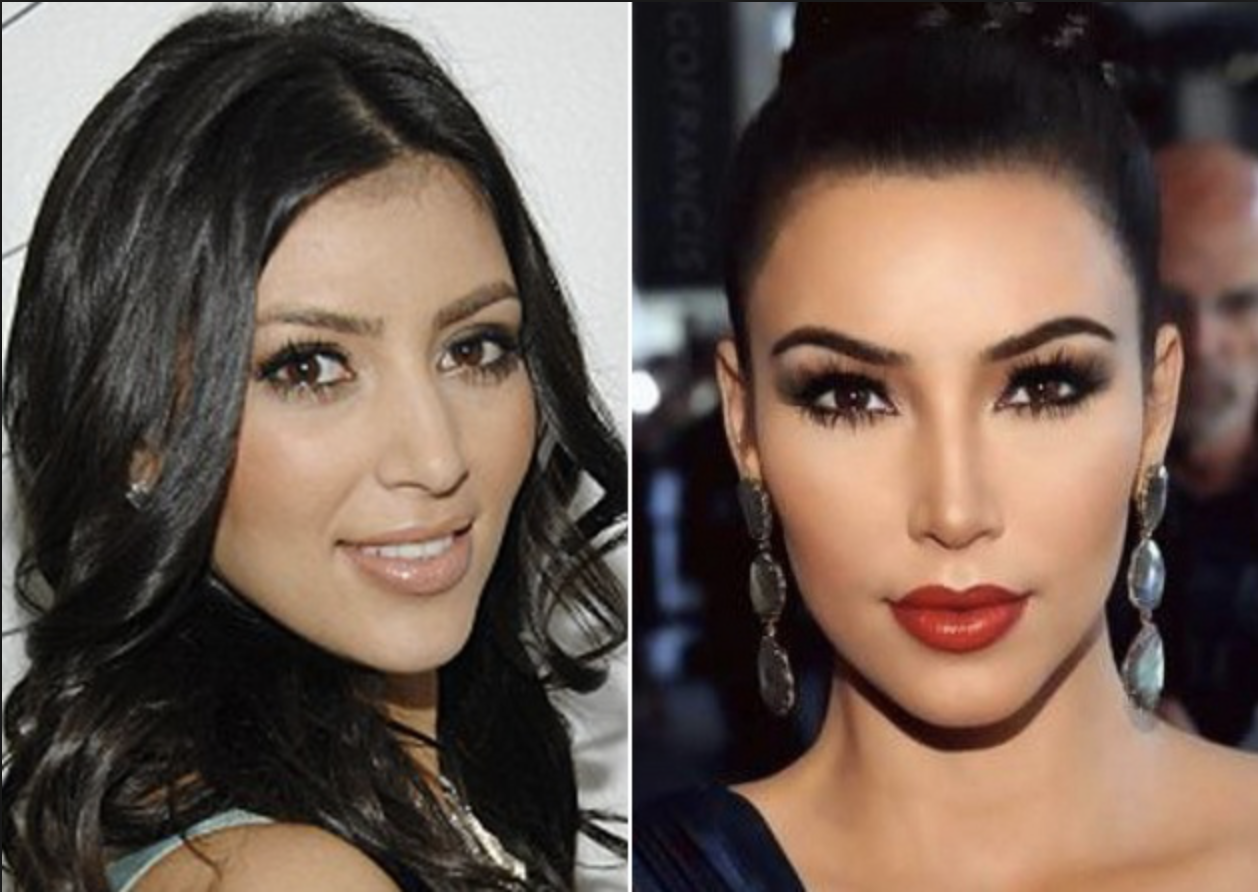 Kim before and after 3 - The Hollywood Gossip