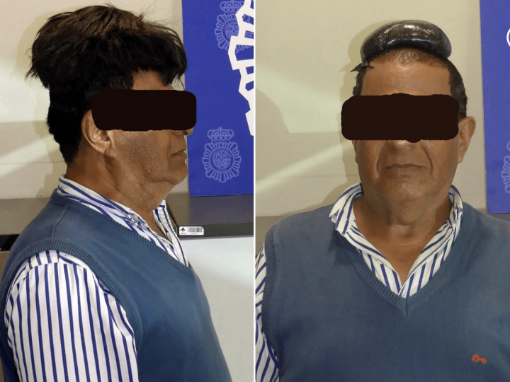 Colombian Dude Hides $34,000 Worth of Coke Under His Wig, Immediately ...