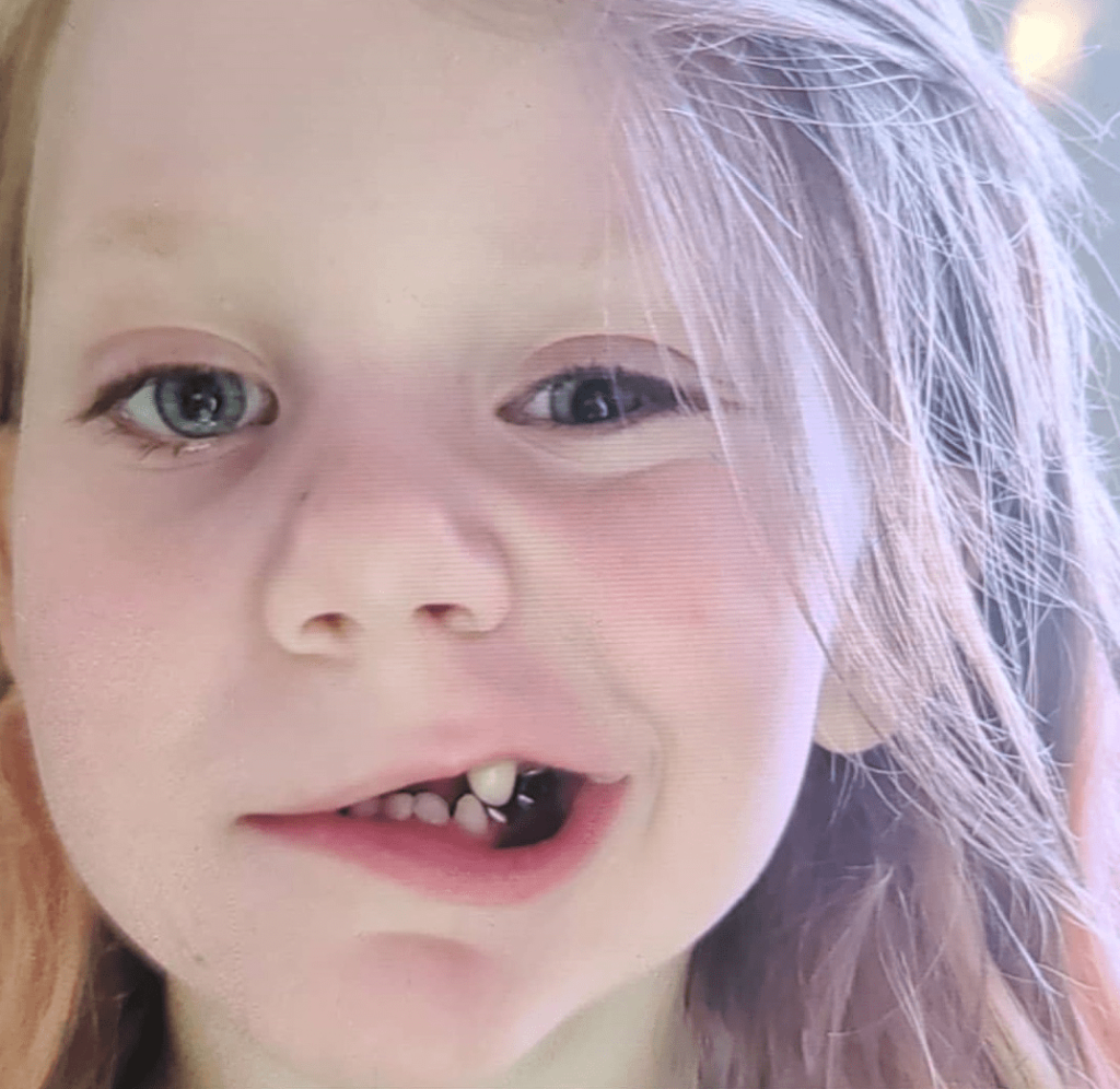 Deavan Clegg Reveals Daughter Drascilla Diagnosed with Bell's Palsy ...