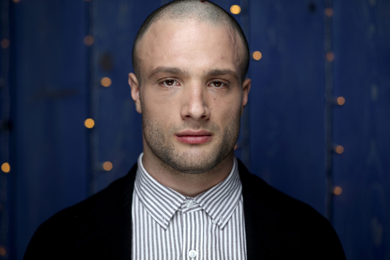 Cosmo Jarvis' Illness: 'Shogun' Actor's Health Issues Explained