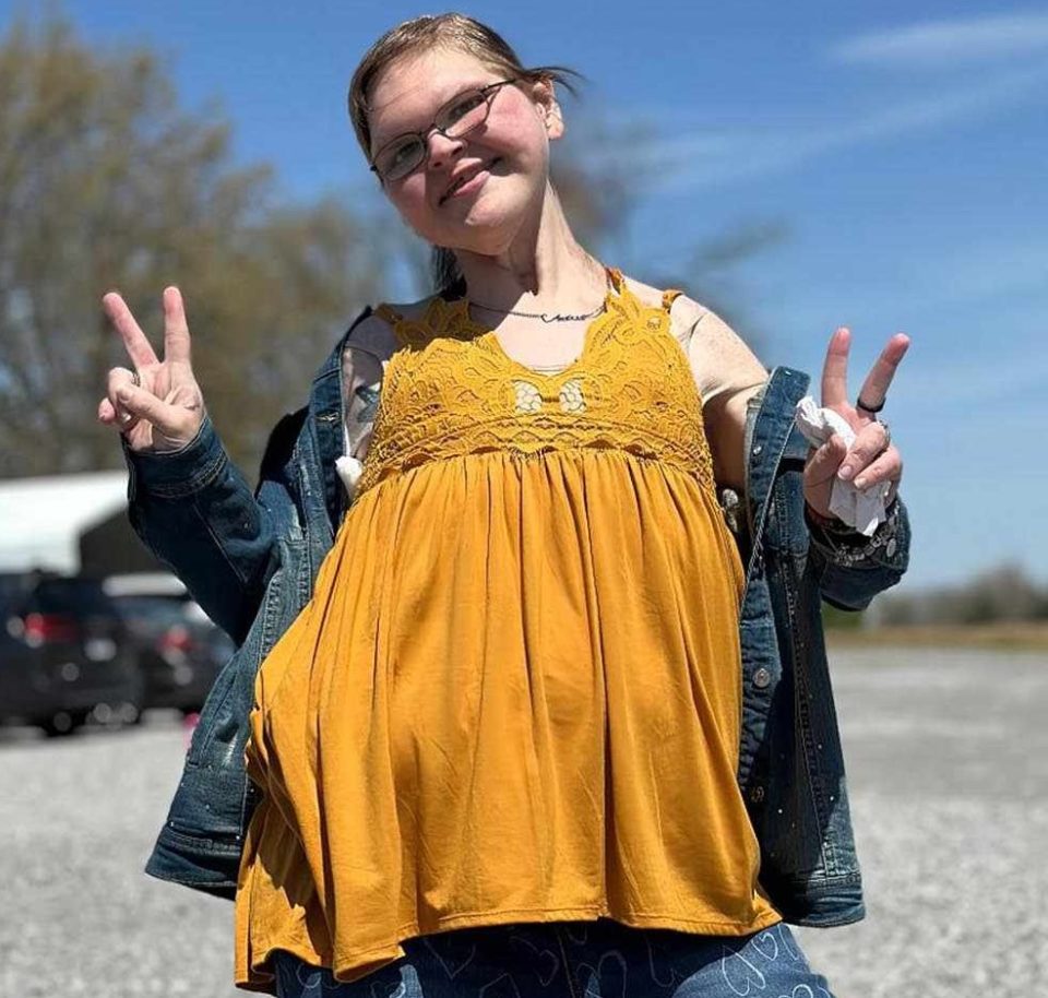 O que aconteceu com o rosto de Tammy Slaton? – Prime Juegos