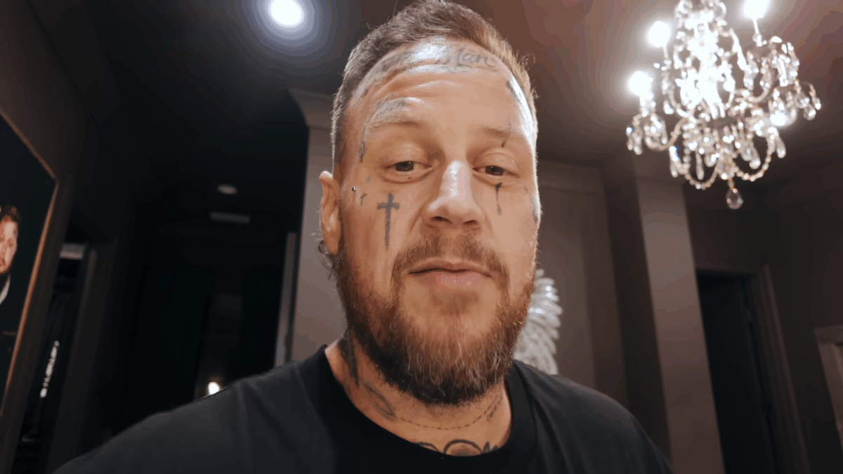 Jelly Roll Reveals 'Secret' Hospitalization, Snapped Collarbone